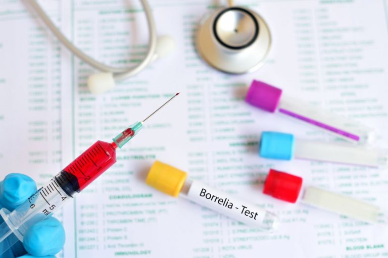 Neuroborelioza – objawy choroby, diagnostyka i leczenie - HelloZdrowie