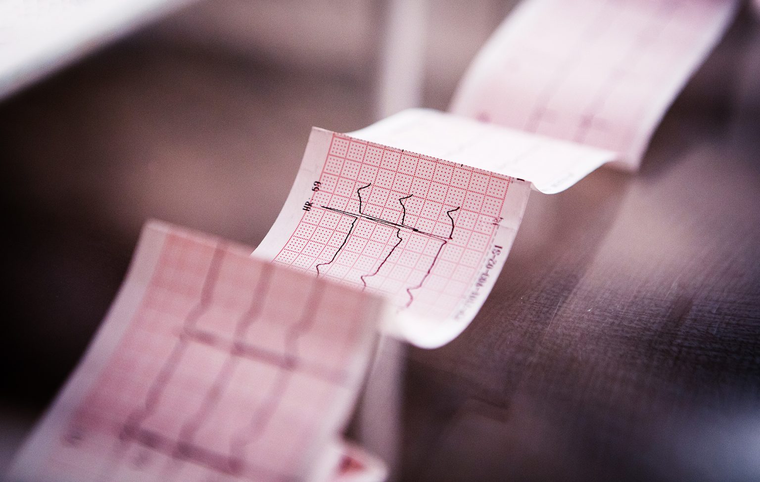 Badanie EMG. Na czym polega elektromiografia i jakie są wskazania?