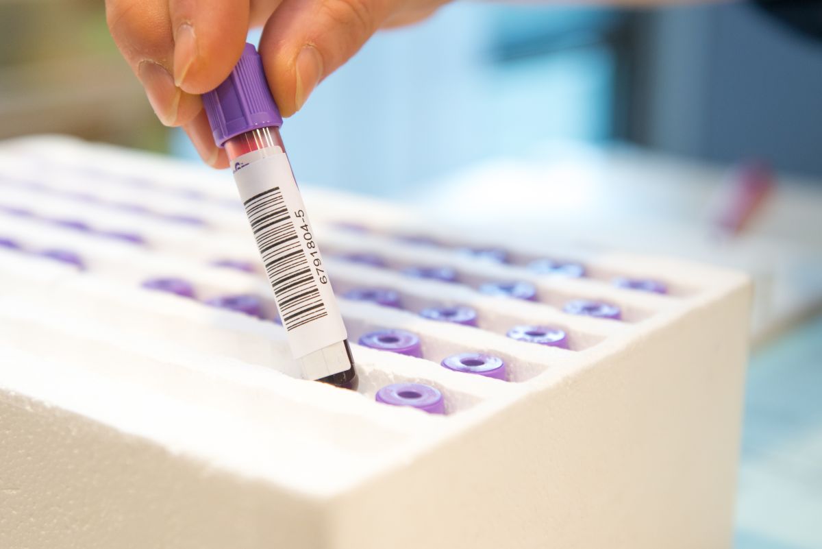 Badanie krwi AspAT - norma, interpretacja wyników | HelloZdrowie