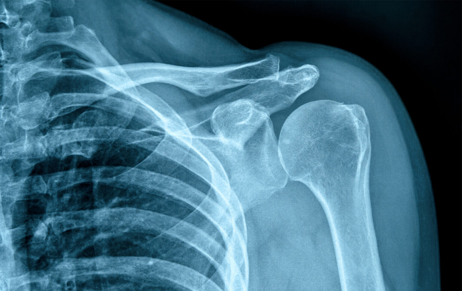 RTG (Rentgen) - co to jest? Na czym polega badanie? | HelloZdrowie