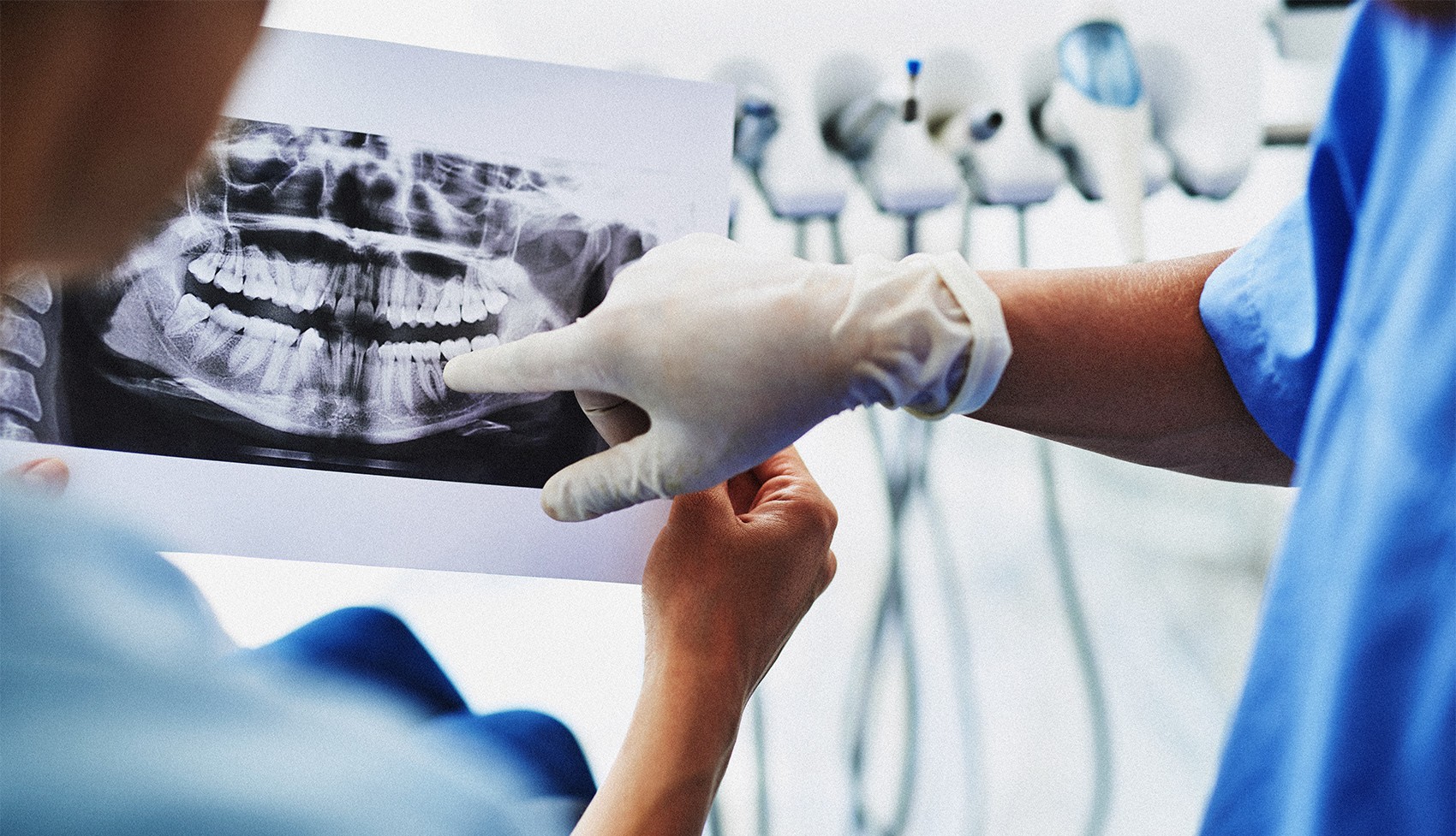 Progenia to wrodzona wada zgryzu. Jakie daje objawy? - HelloZdrowie