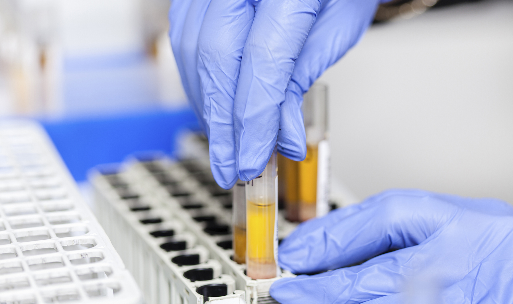 Amoniak w moczu i we krwi - badanie, norma, zatrucie amoniakiem ...