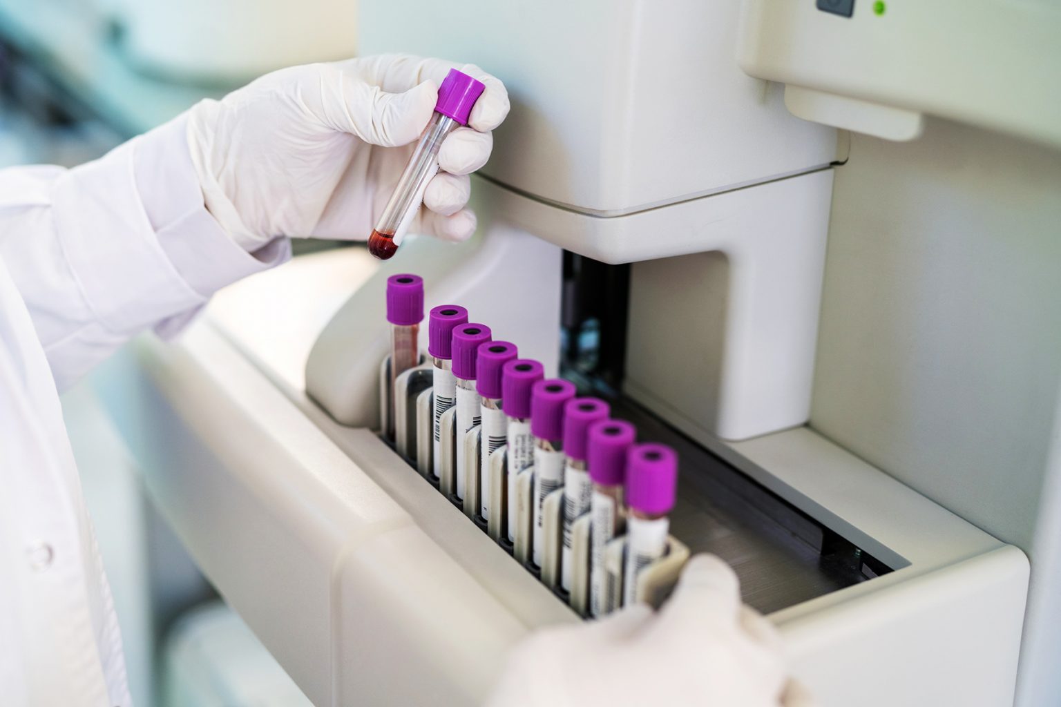 Jak usunąć tłuszczaka domowymi sposobami? | HelloZdrowie