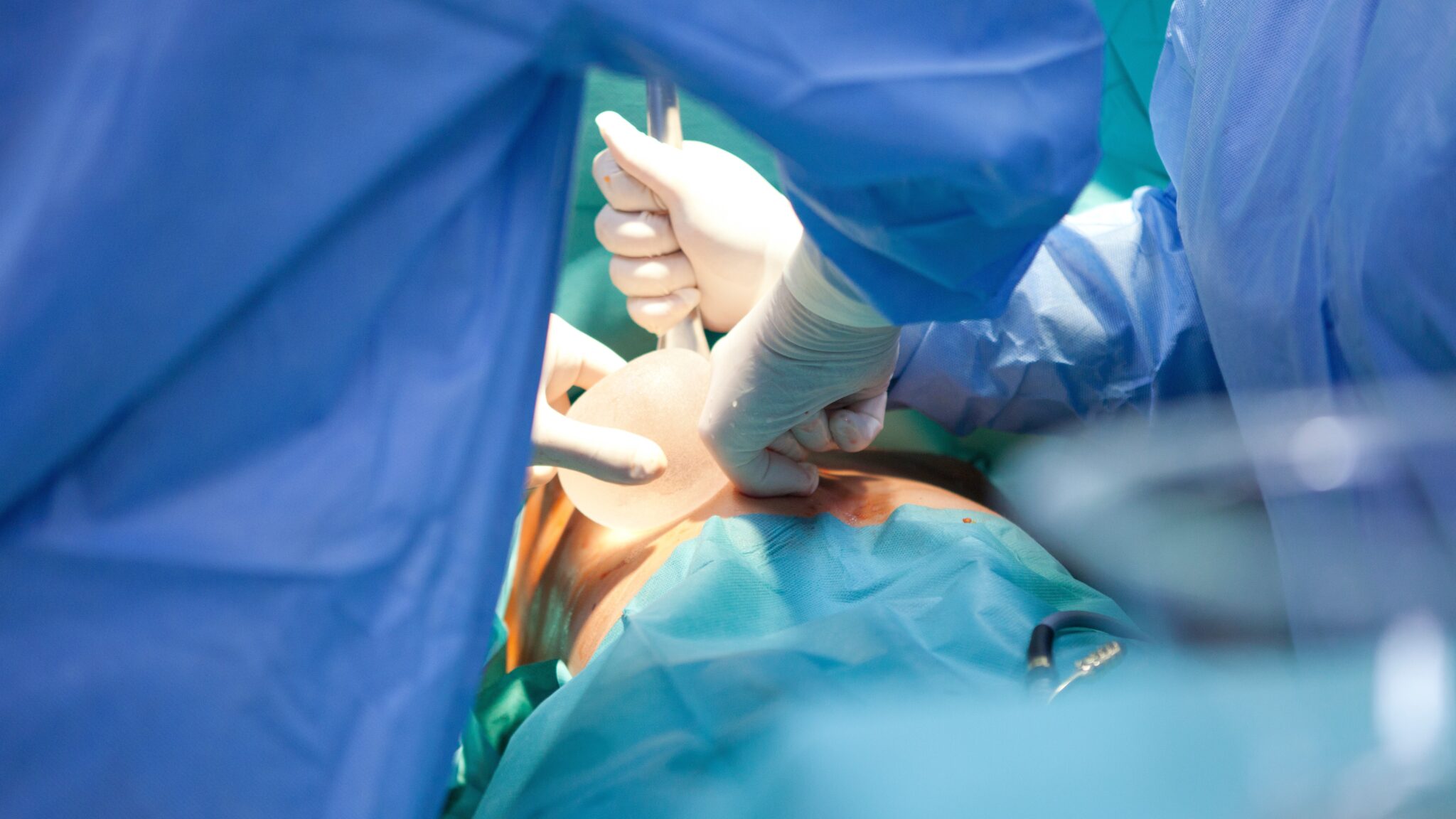 Czym jest ziarnina i jak ją skutecznie leczyć? | HelloZdrowie