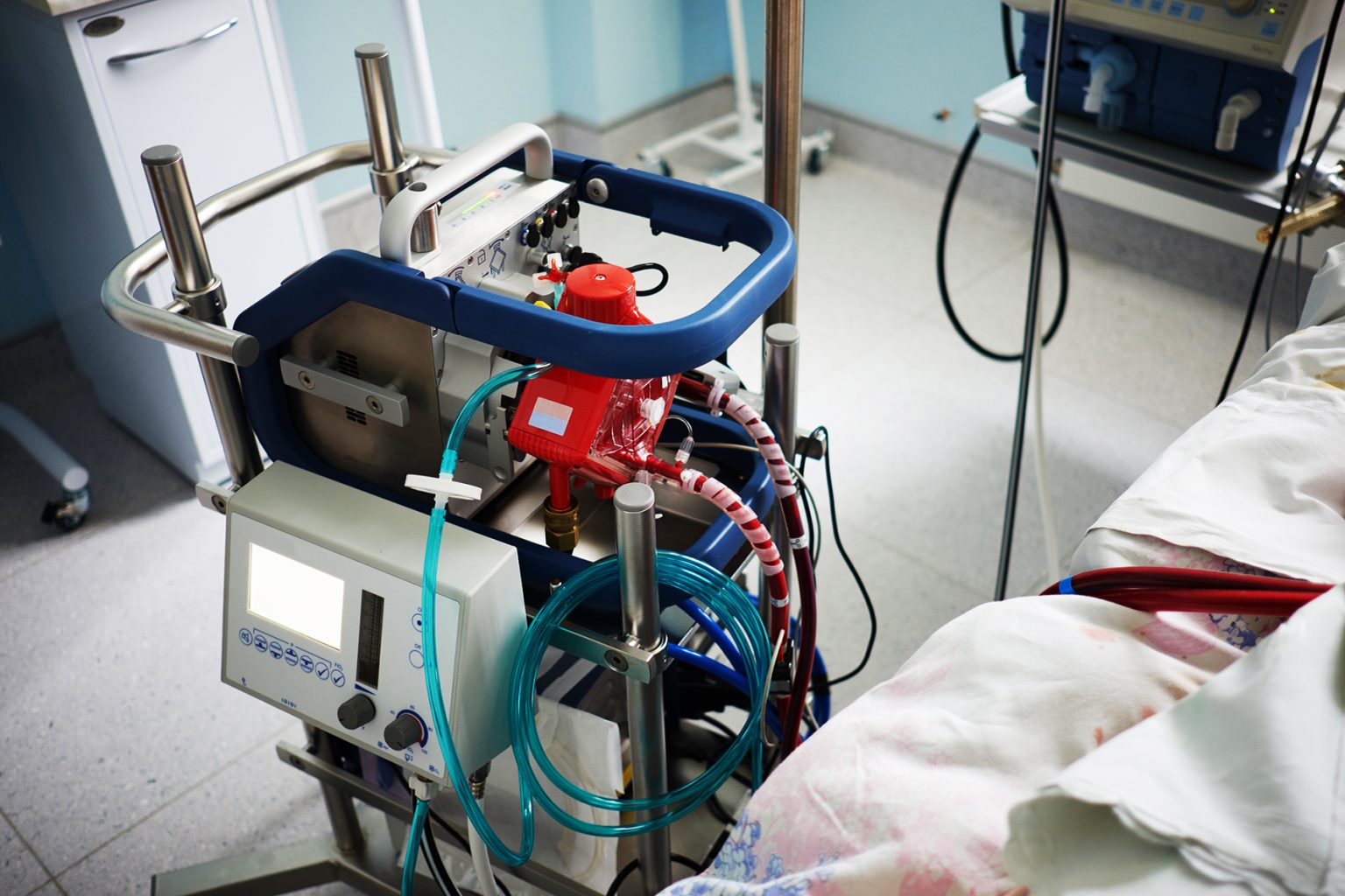 ECMO – urządzenie, które daje płucom i sercu czas na regenerację lub ...