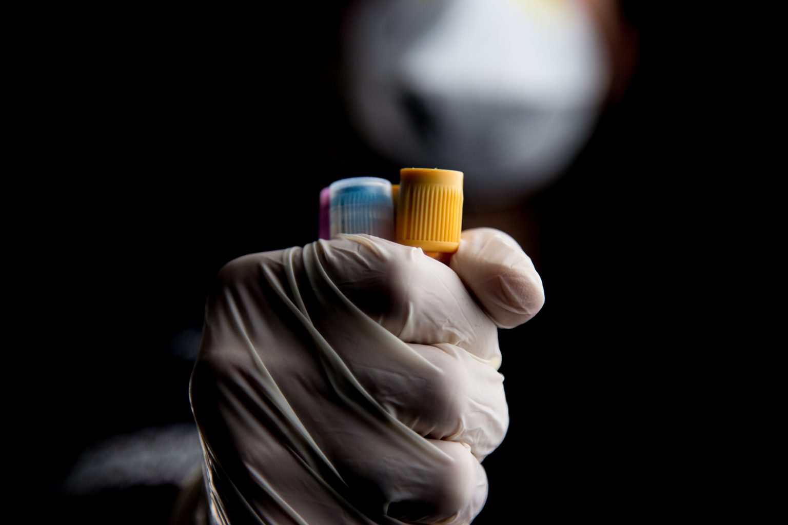 Czym się zajmuje hematolog i kiedy wymagana jest wizyta u tego ...