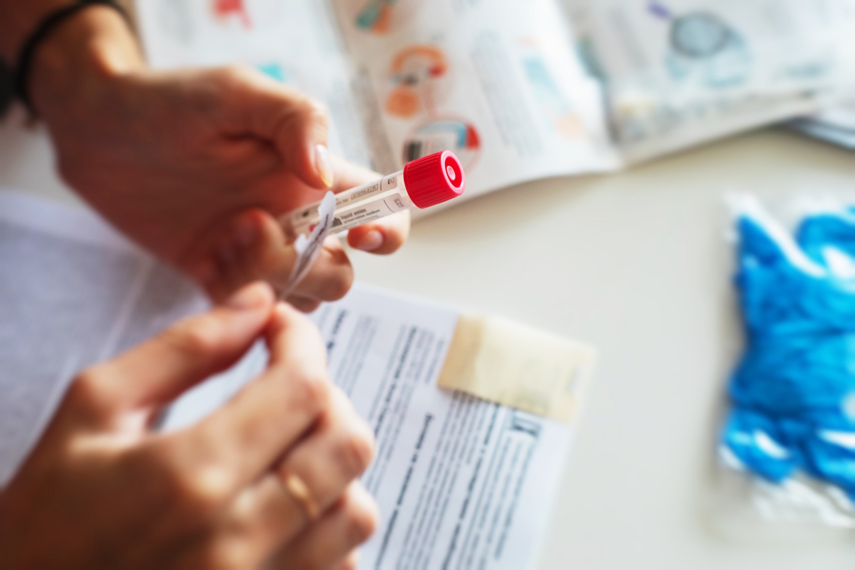 Co najbardziej wypłukuje potas z organizmu? Zobacz