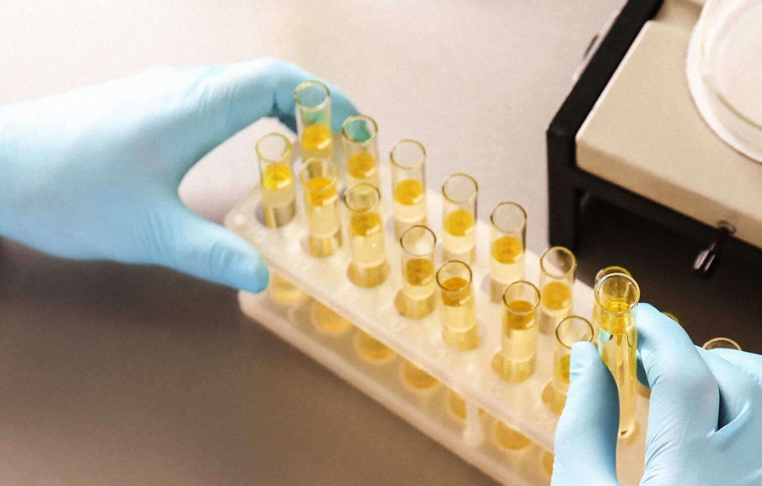 Azotyny w moczu - co oznaczają? Jakie są ich przyczyny?