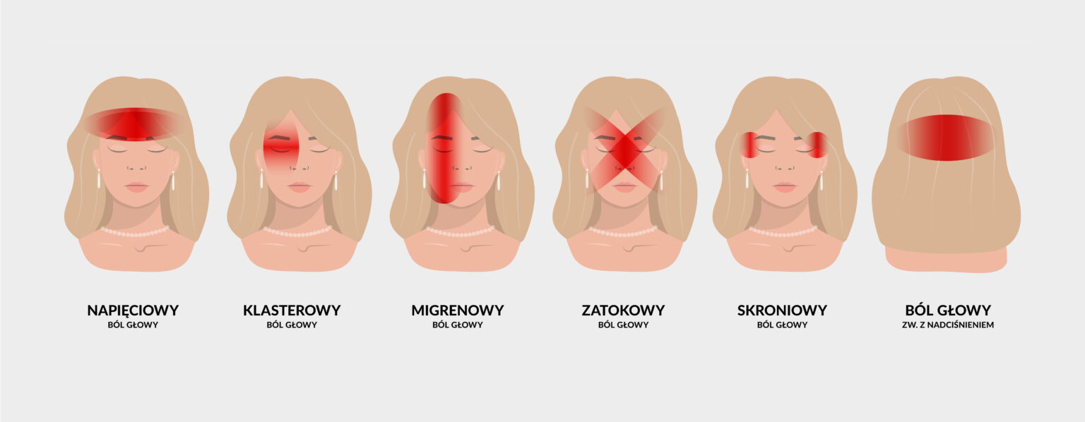 Co oznacza kłujący ból głowy? Czym jest samoistny kłujący ból głowy ...