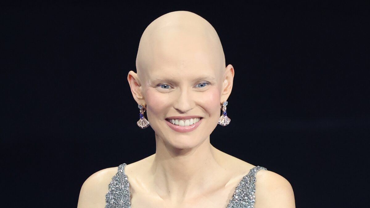 Czym jest potworniak? Przyczyny, objawy, leczenie | HelloZdrowie