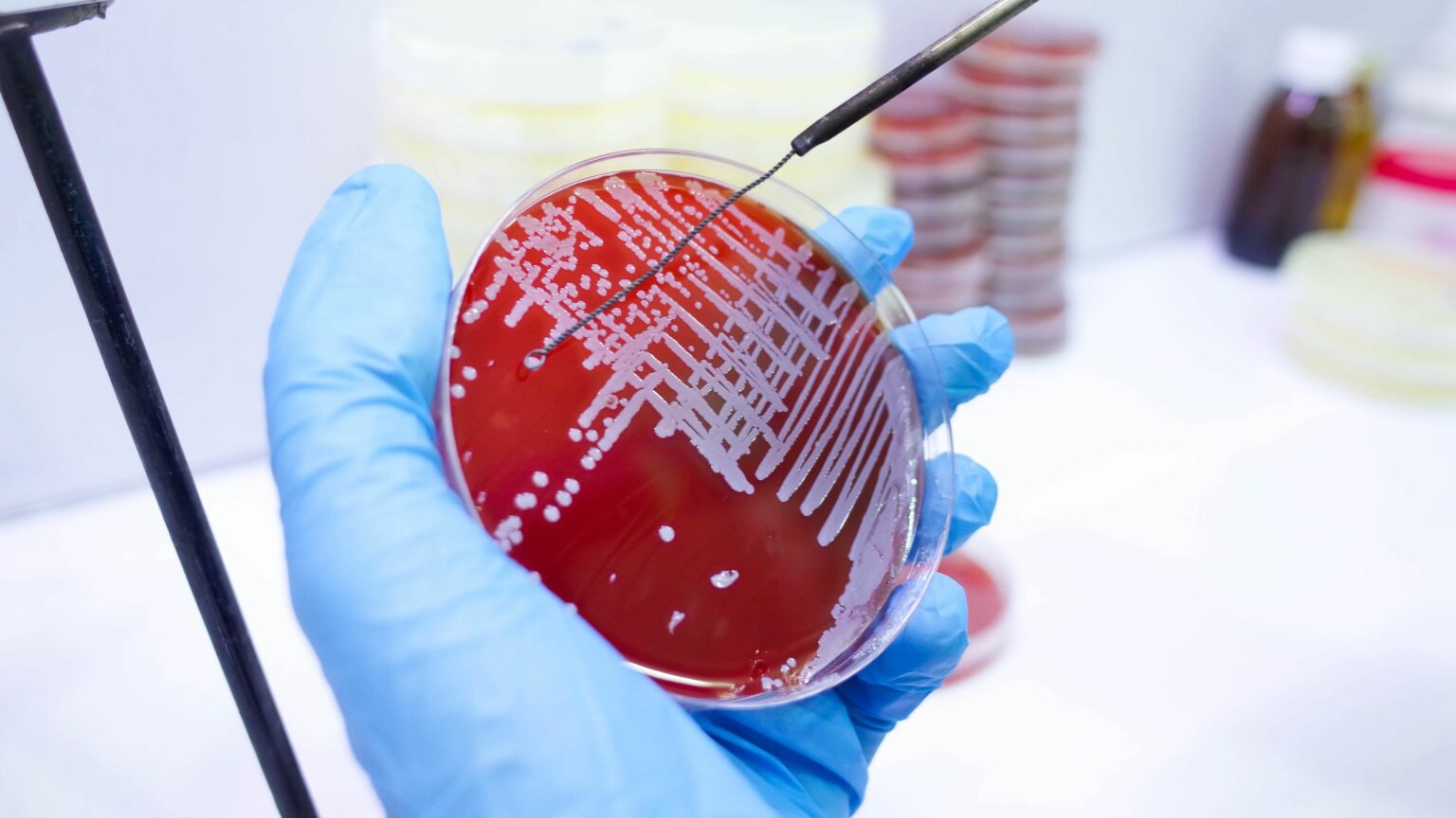 Penicylina – antybiotyk, który powstał przez przypadek. Poznaj jego ...