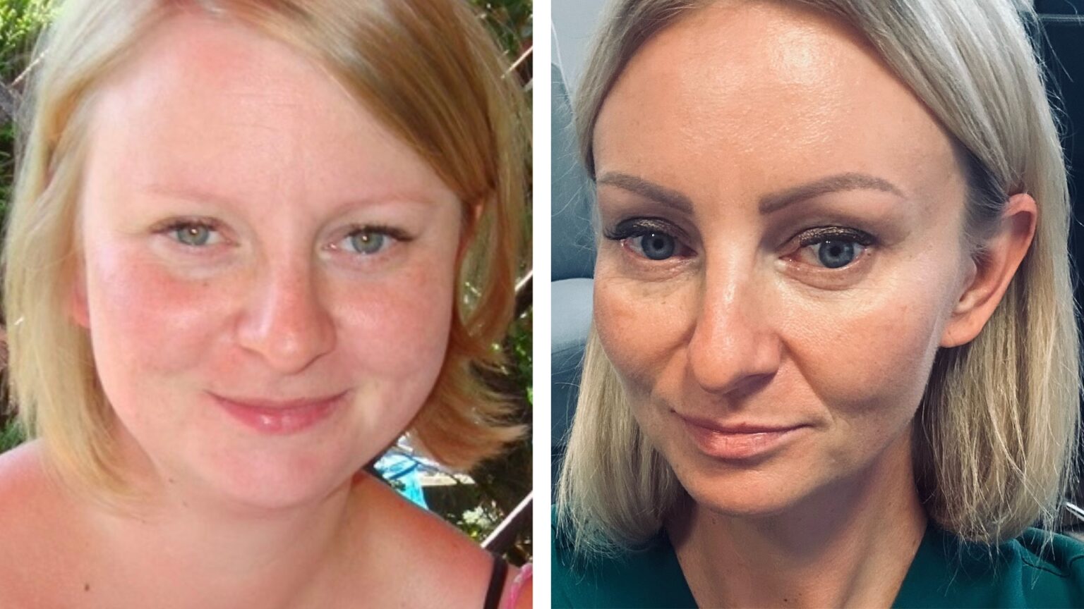 Diureza – co to takiego i jaka jest norma? Czym różni się diureza ...